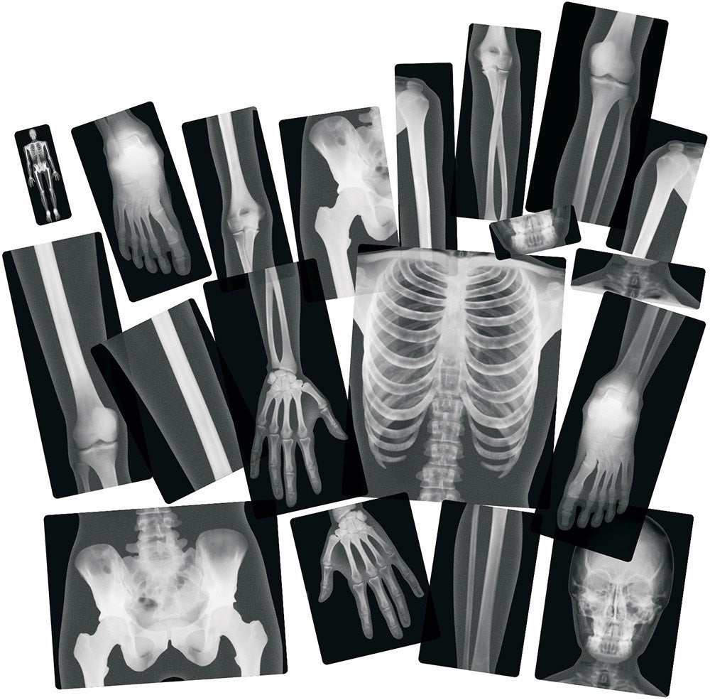 True to Life Human X-Rays 18pcs – Edu-21